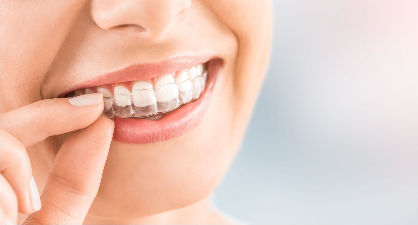 Invisalign New York - Raio Dental